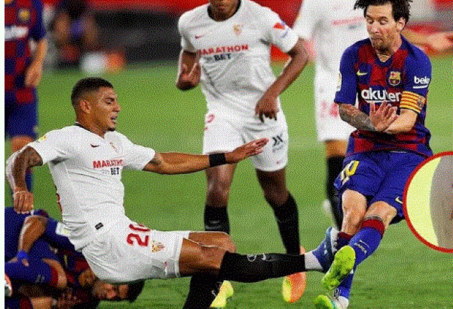 Photo: Lionel Messi nasty injury on show in training