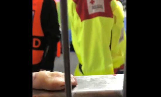 West Ham fan loses a finger - video