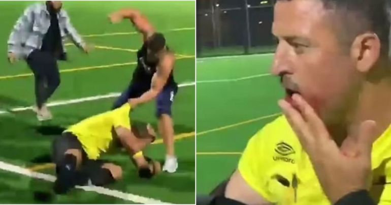 Player arrested for assault on referee that leaves the official with a ...
