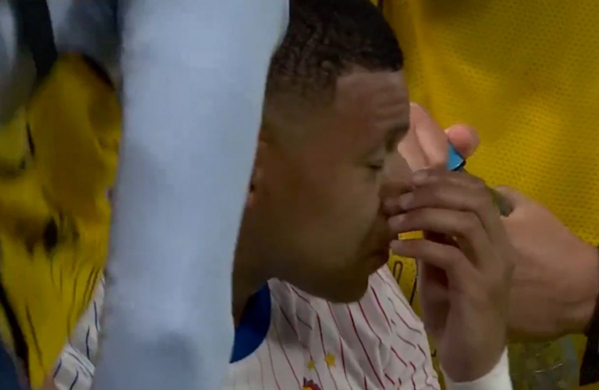 Video: Kylian Mbappe's nose injury gets hit again at Euro 2024