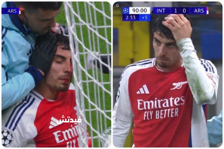 Kai Havertz leaves UCL clash covered in blood ahead of Chelsea match