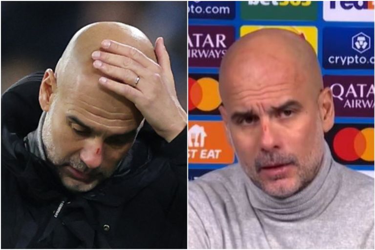 Pep Guardiola explains scratches after Man City vs Feyenoord